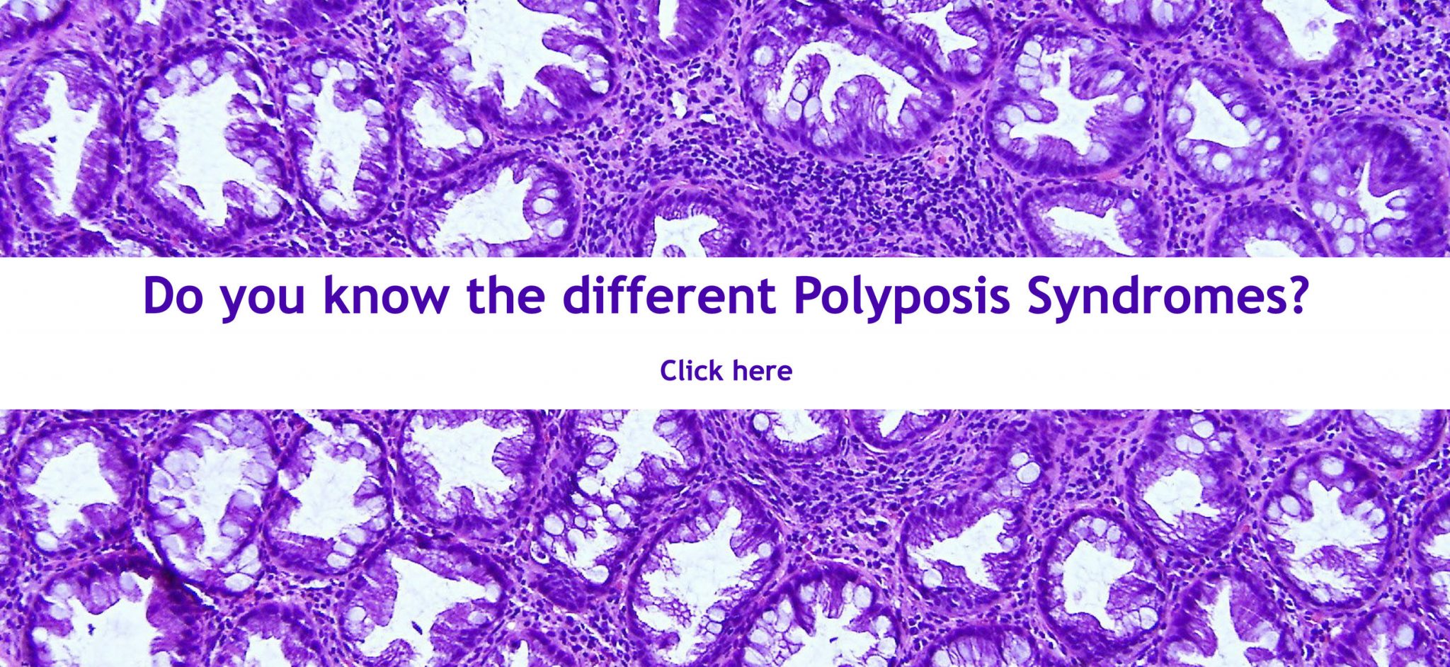 A support group for those affected by Polyposis Syndromes